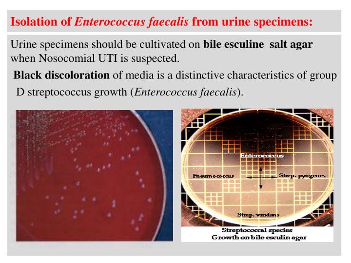PPT - Urinary tract infection ( UTI ) PowerPoint Presentation - ID:2101291