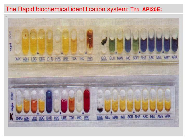 PPT - Urinary tract infection ( UTI ) PowerPoint Presentation - ID:2101291