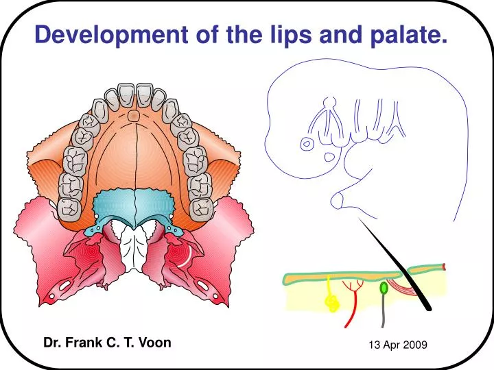 PPT - Development of the lips and palate. PowerPoint Presentation, free ...