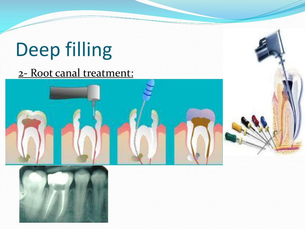 PPT - By: Dr. Nour Wahba Dental Intern Faculty of Dentistry Ain Shams ...