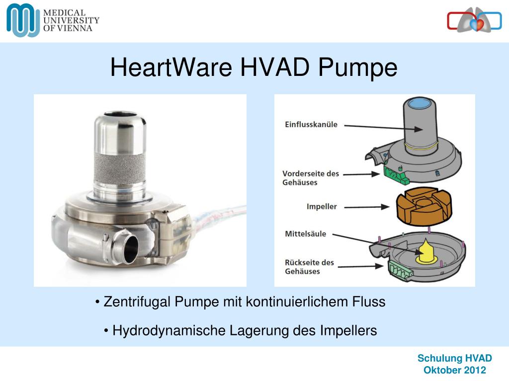 PPT - Left Ventricular Assist Device (LVAD) HeartWare HVAD T ...