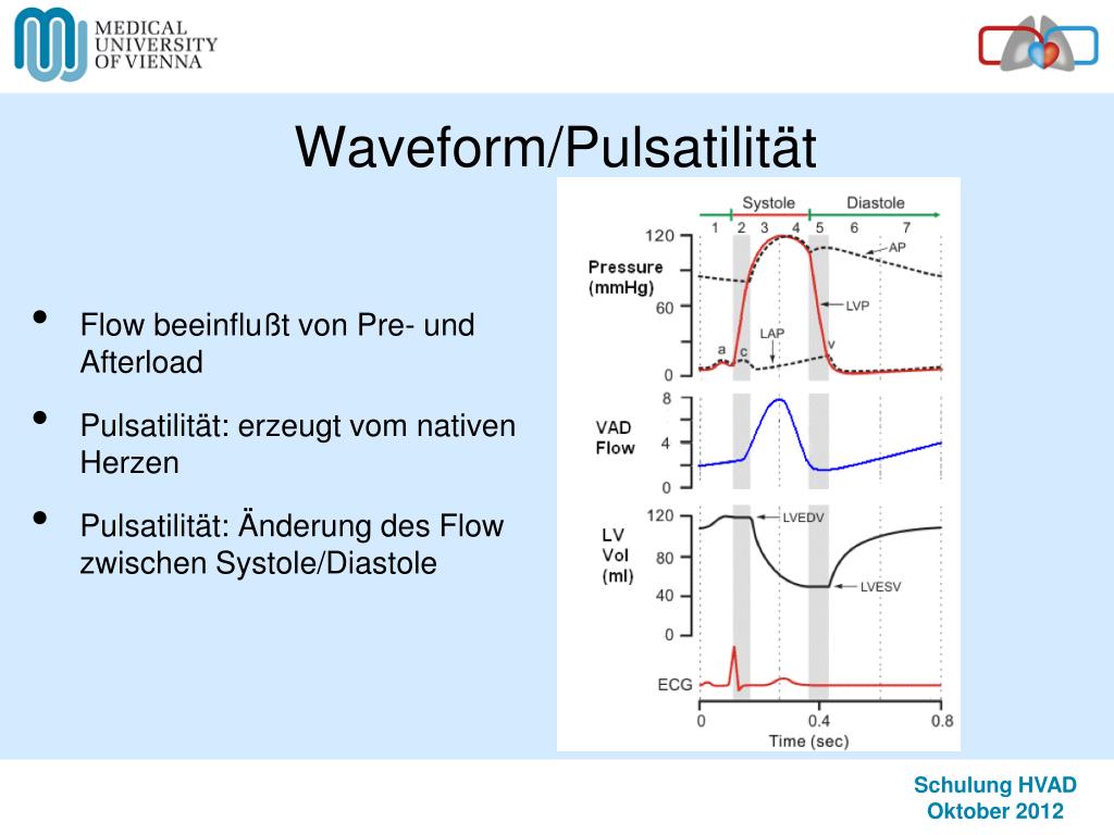 PPT - Left Ventricular Assist Device (LVAD) HeartWare HVAD T ...