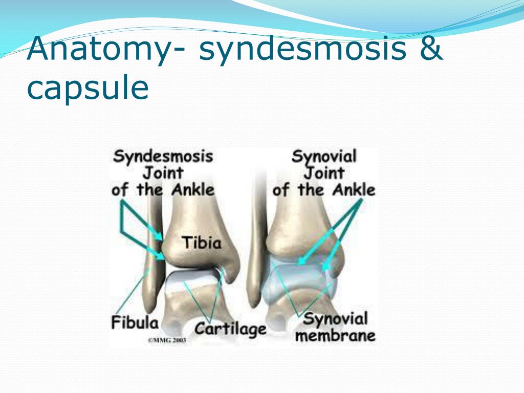 PPT - Derbyshire Sports Injuries Clinic presents PowerPoint ...