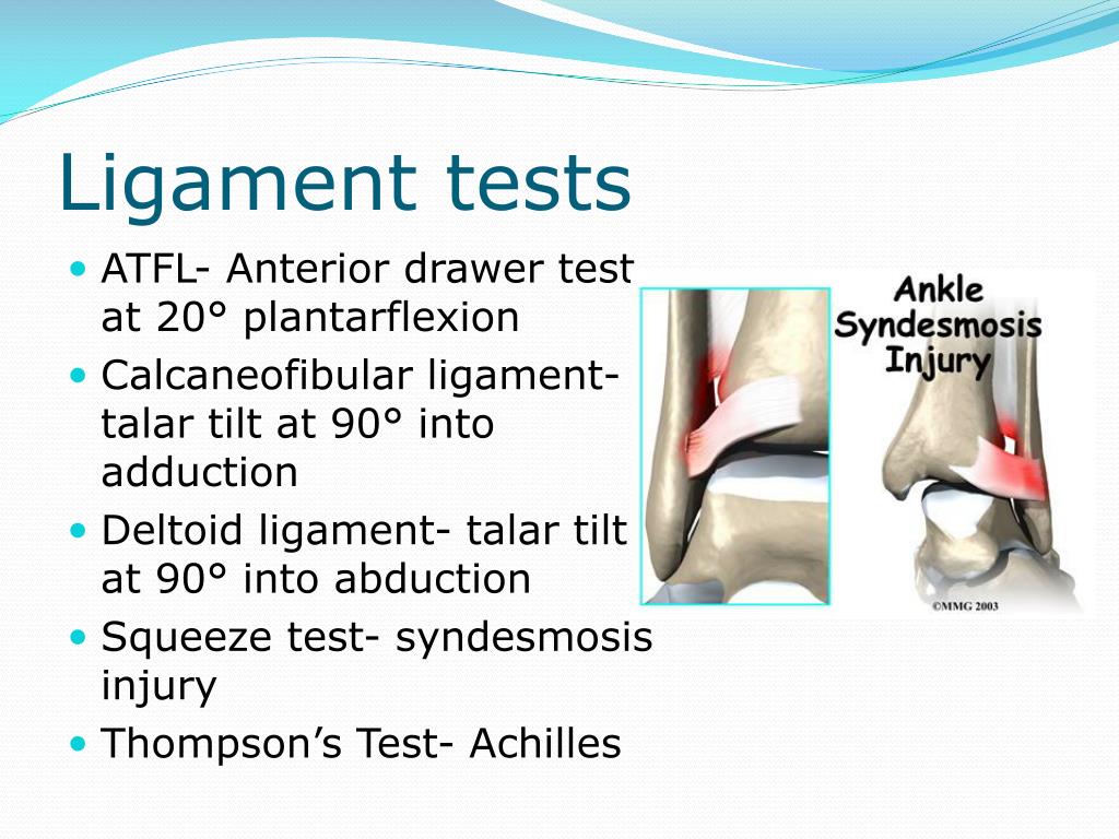 PPT - Derbyshire Sports Injuries Clinic presents PowerPoint ...