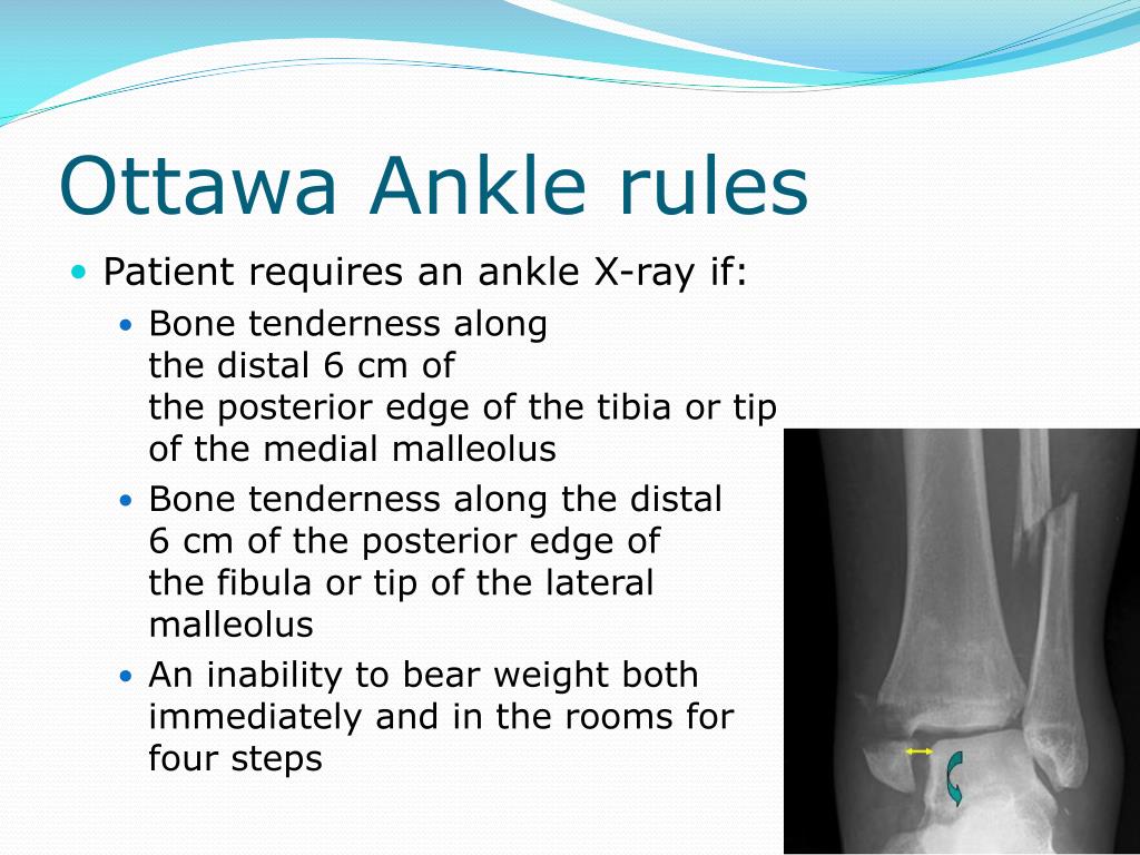 PPT - Derbyshire Sports Injuries Clinic presents PowerPoint ...