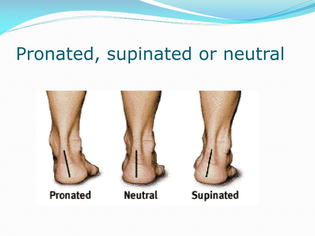 PPT - Derbyshire Sports Injuries Clinic presents PowerPoint ...