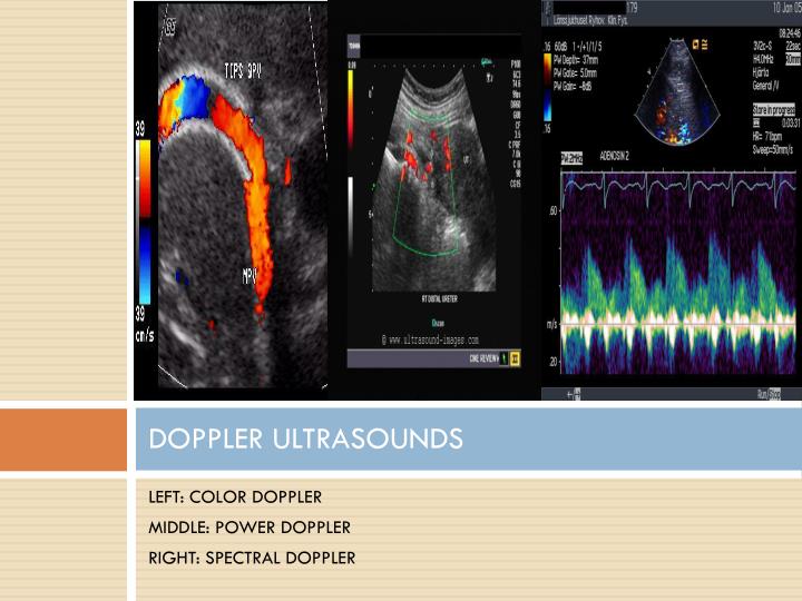 PPT - Looking into you: Ultrasound PowerPoint Presentation - ID:2103992