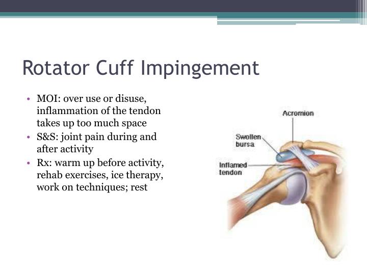PPT - Shoulder Injuries PowerPoint Presentation - ID:2104236