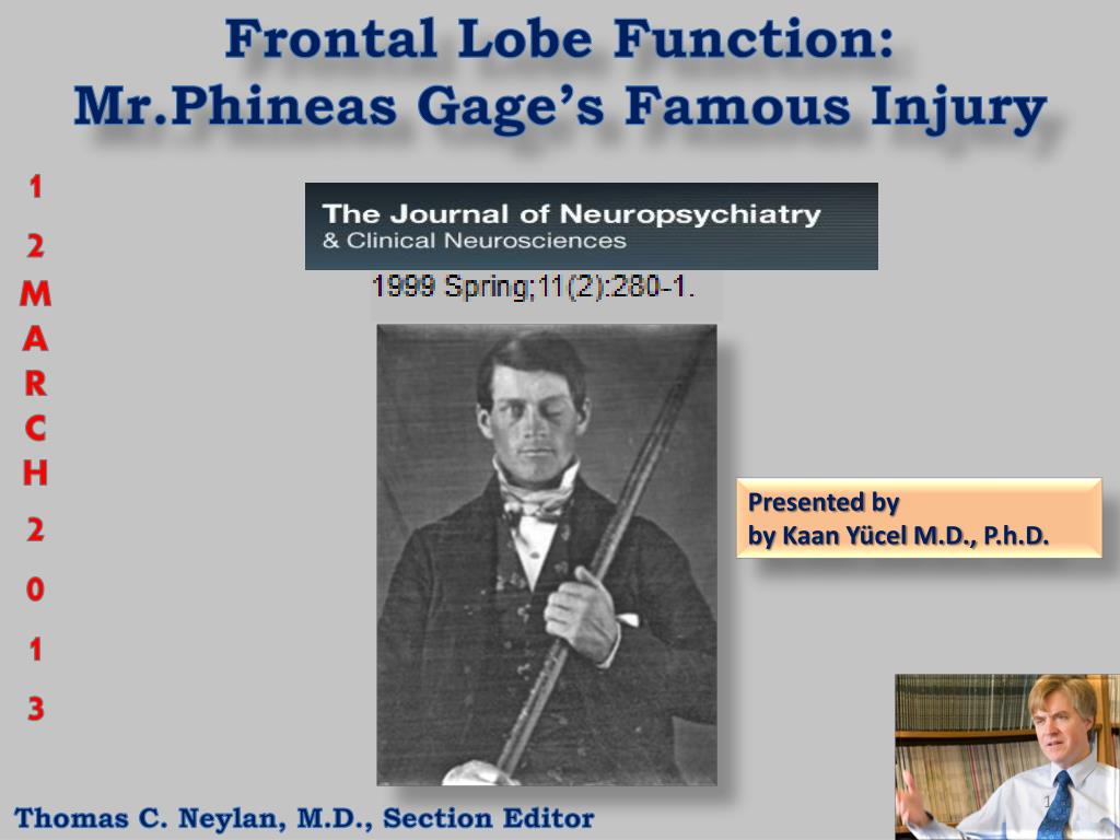 PPT - Frontal Lobe F u nction : Mr.Phineas Gage’s Famous Injury ...