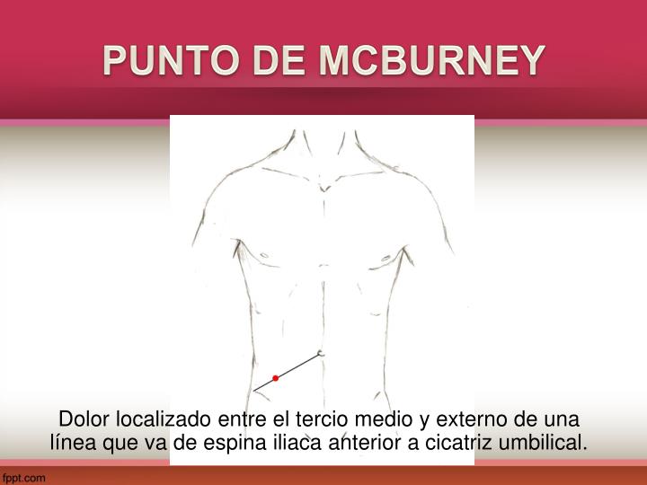 PPT - aPENDICITIS PowerPoint Presentation - ID:2106007