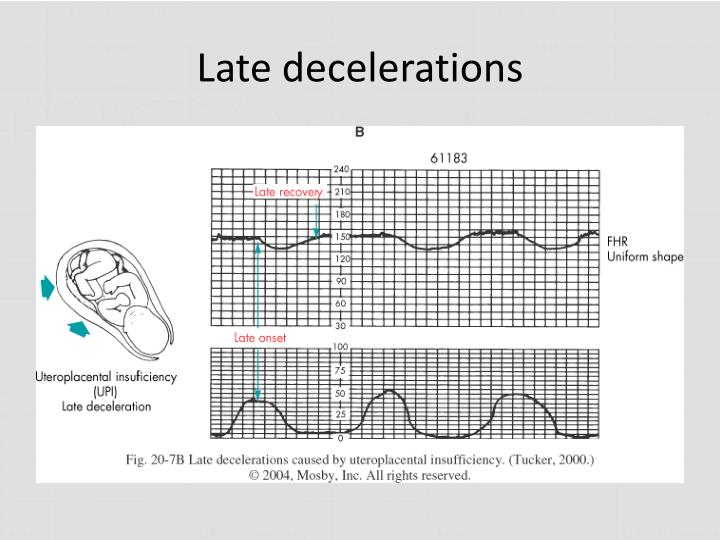 PPT - Fetal Assessment in labor PowerPoint Presentation - ID:2108127