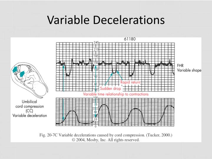 PPT - Fetal Assessment in labor PowerPoint Presentation - ID:2108127