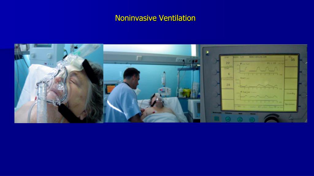 PPT - Antonio M. Esquinas MD, PhD, FCCP, Internacional Fellow AARC ...