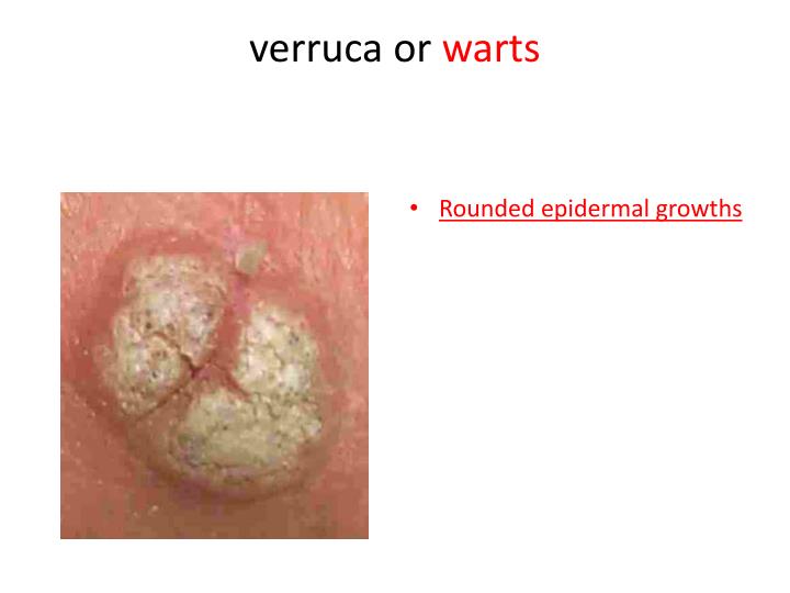 PPT - Integumentary System and Accessory Organs PowerPoint Presentation ...
