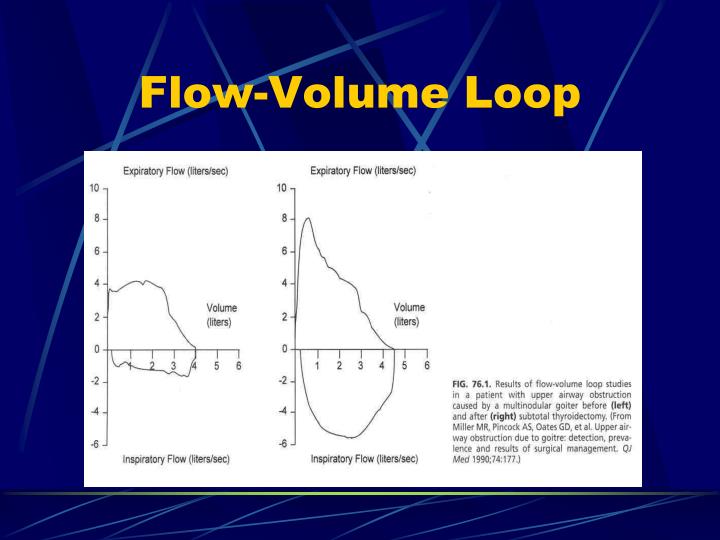 PPT - Simple (Nontoxic) Goiter: Diffuse and Multinodular PowerPoint ...