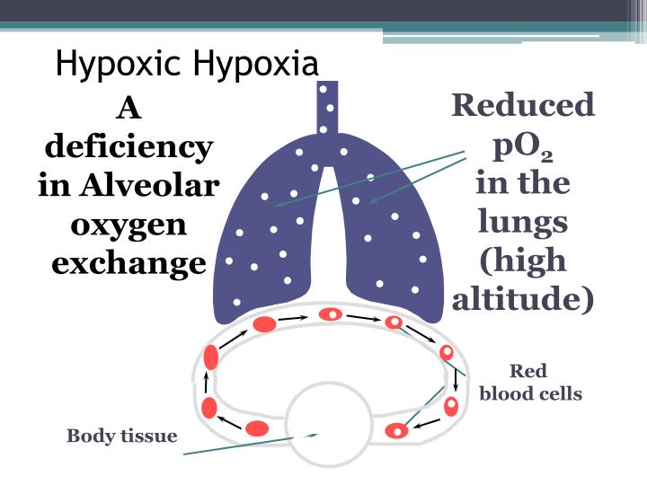 PPT - Hypoxia PowerPoint Presentation - ID:2108626