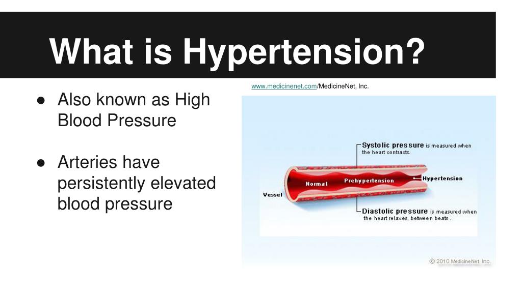 PPT - Hypertension PowerPoint Presentation, free download - ID:2108712