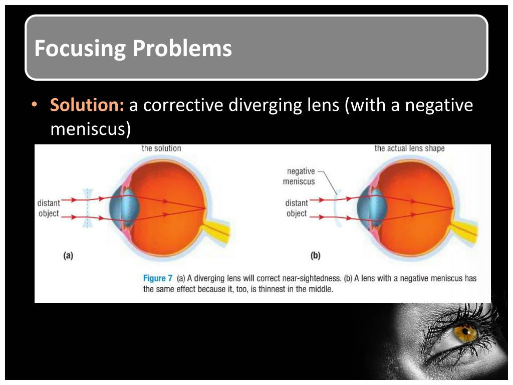 PPT - The Human Eye PowerPoint Presentation, free download - ID:2109480
