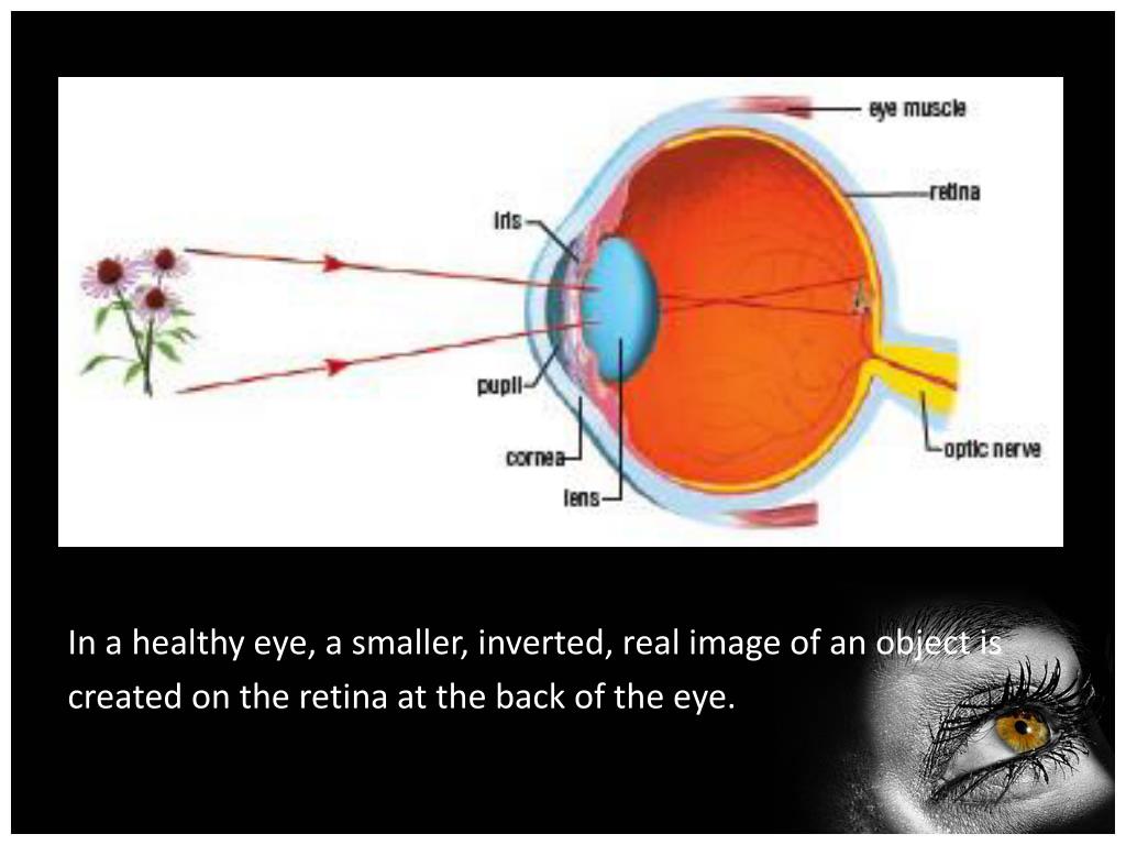 PPT - The Human Eye PowerPoint Presentation, free download - ID:2109480