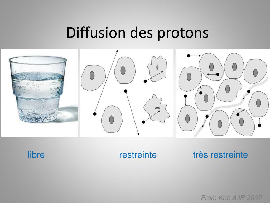 PPT - IRM hépatique « pour les hépatologues » PowerPoint Presentation ...