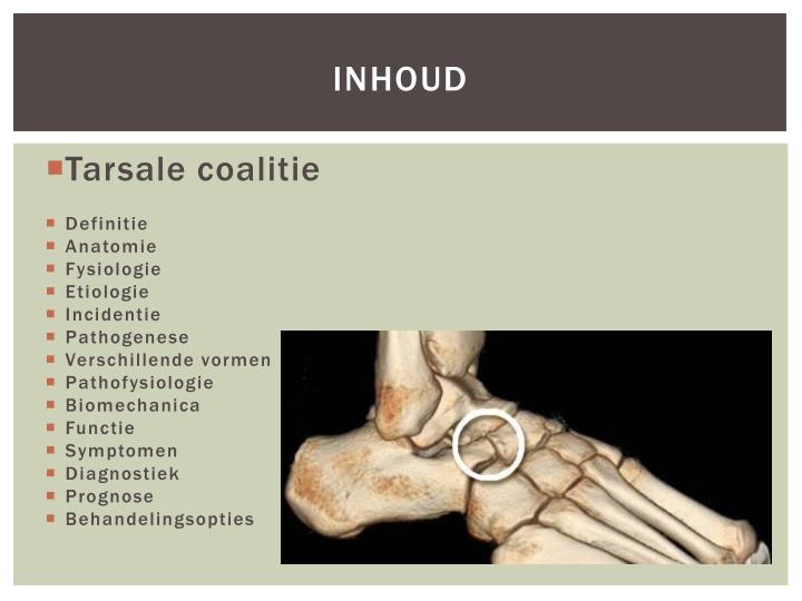 PPT - Tarsale coalitie PowerPoint Presentation - ID:2109570