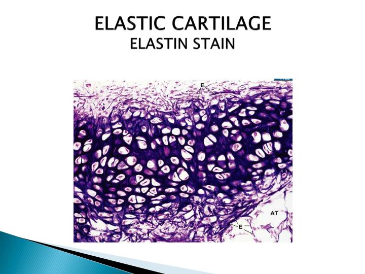 PPT - CARTILAGE PowerPoint Presentation - ID:2110122