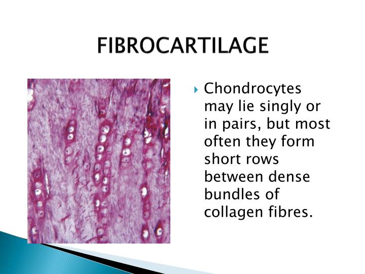 PPT - CARTILAGE PowerPoint Presentation - ID:2110122