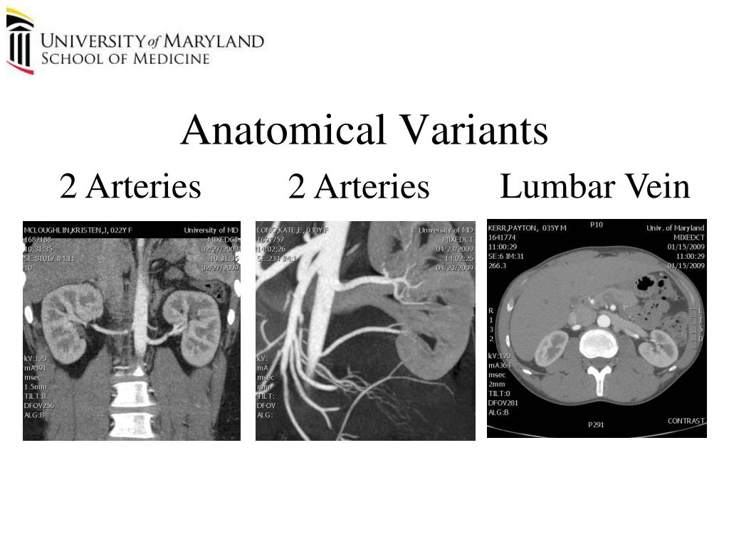 PPT - Rolf N. Barth, M.D. Department of Surgery University of Maryland ...