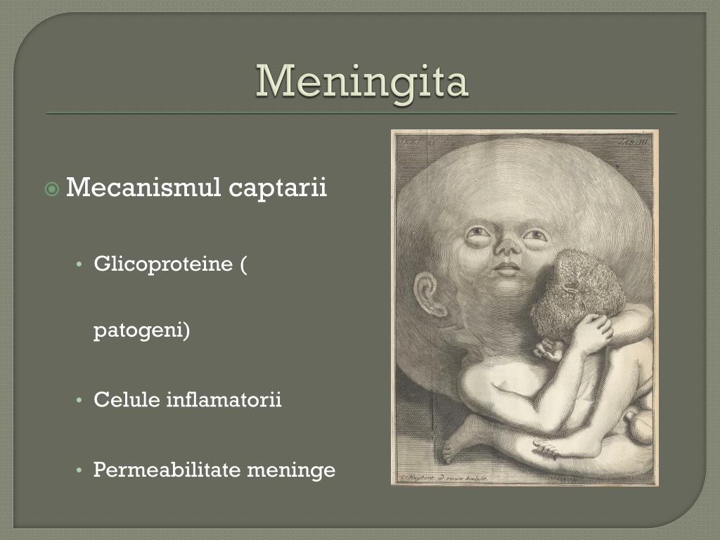 PPT - Putina anatomie … Fara nu se poate … PowerPoint Presentation - ID ...