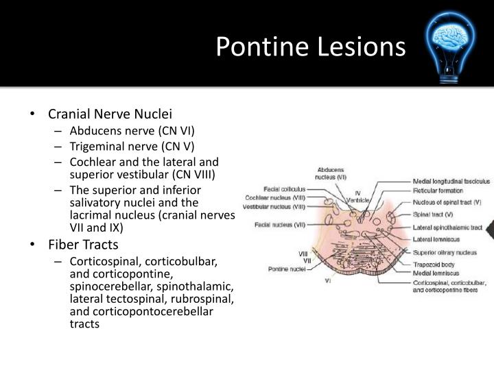 PPT - DisPONnect PowerPoint Presentation - ID:2114109