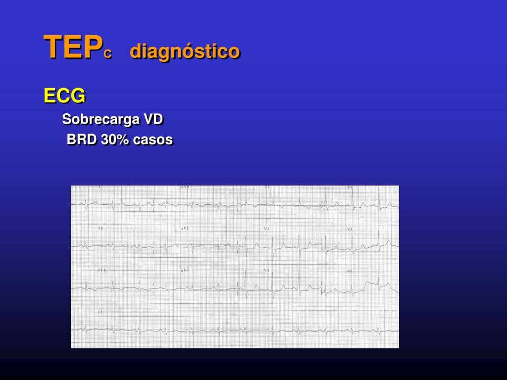 PPT - TROMBOEMBOLISMO PULMONAR CRÔNICO PowerPoint Presentation, free ...