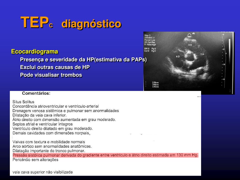 PPT - TROMBOEMBOLISMO PULMONAR CRÔNICO PowerPoint Presentation, free ...