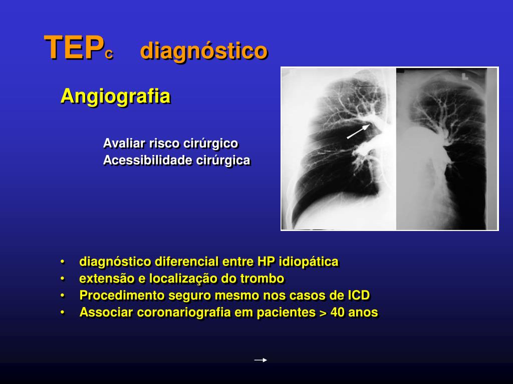 PPT - TROMBOEMBOLISMO PULMONAR CRÔNICO PowerPoint Presentation, free ...