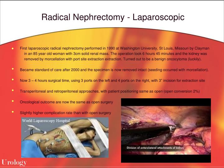 PPT - Kidney Cancer – RCC & TCC PowerPoint Presentation - ID:2118255