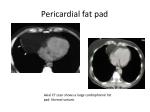 PPT - Imaging Anatomy of the Heart and Great Vessels PowerPoint ...