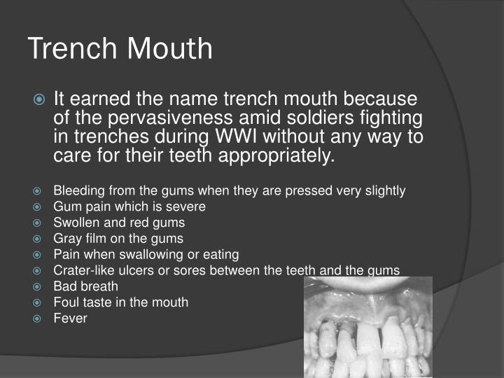 PPT - Essential Question: Did the benefits of trench warfare outweigh ...