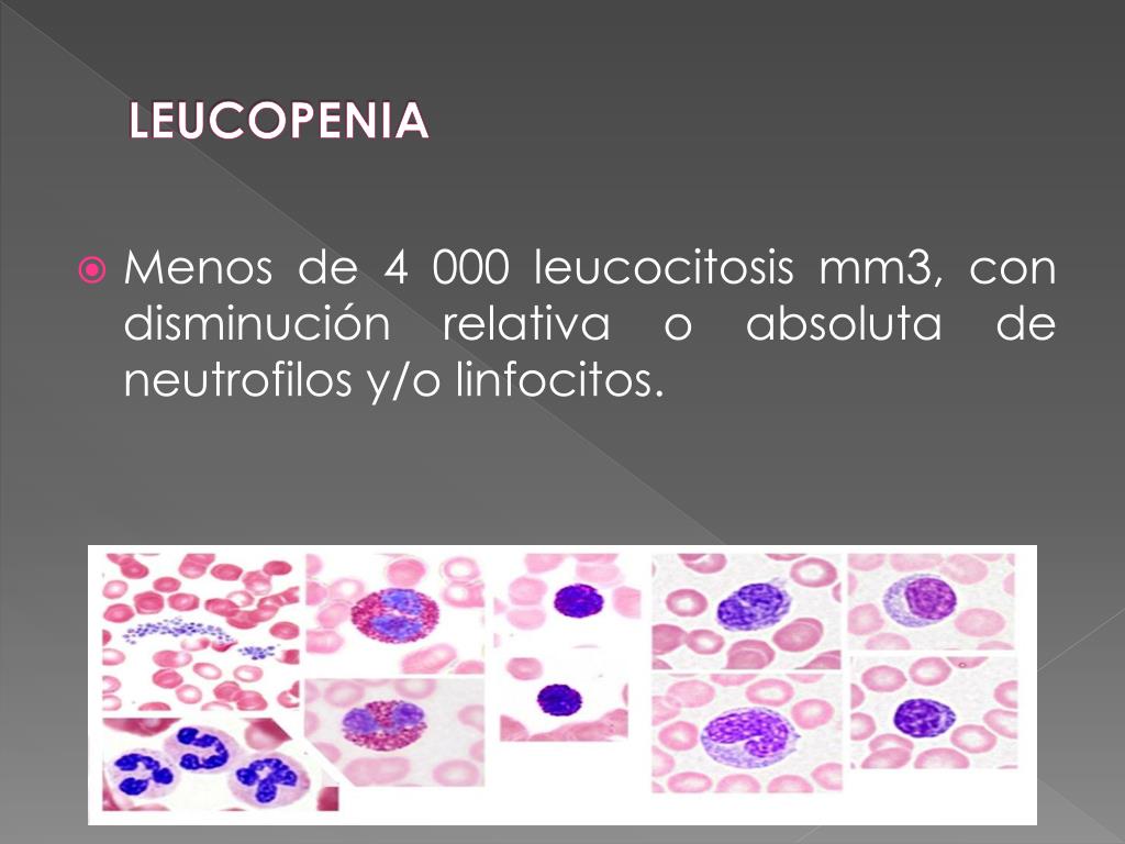 PPT - INTERPRETACION DEL HEMOGRAMA EN PEDIATRIA PowerPoint Presentation ...