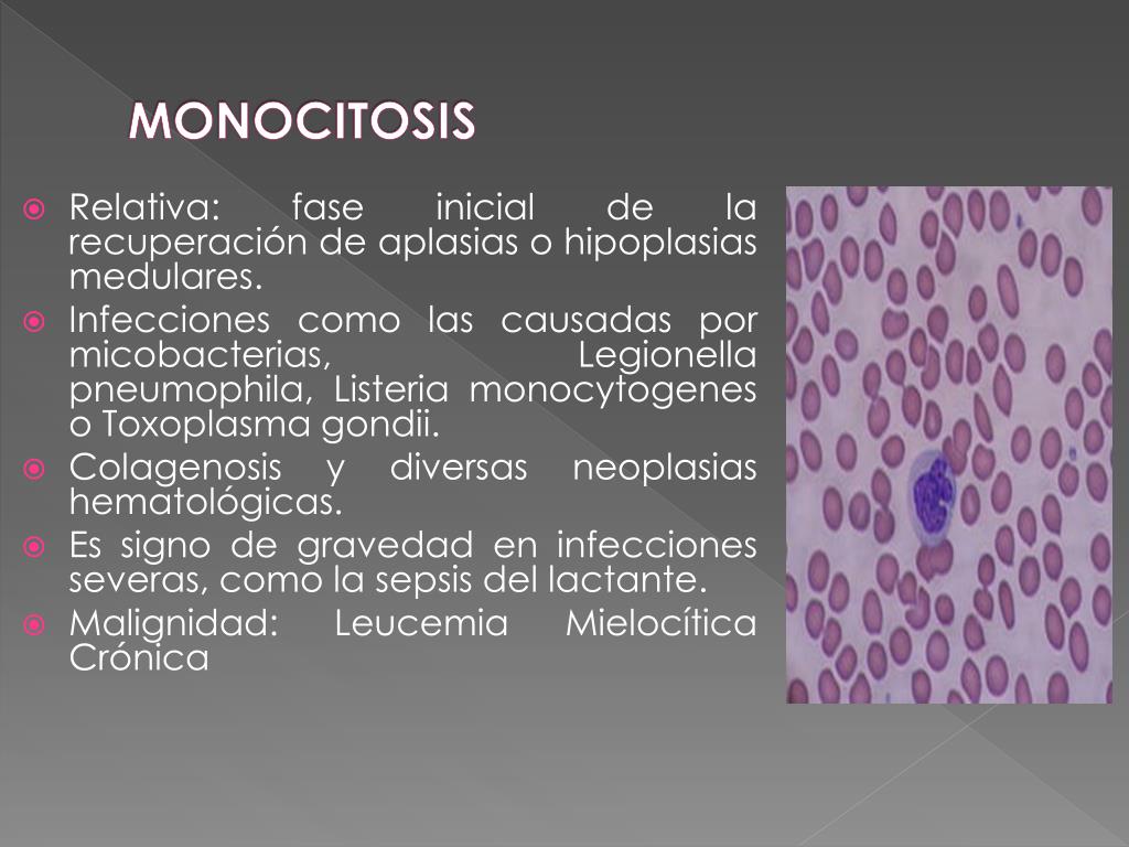 PPT - INTERPRETACION DEL HEMOGRAMA EN PEDIATRIA PowerPoint Presentation ...