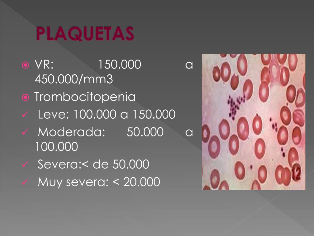 Valores Normales De Plaquetas En Niños Y Adultos – SVFH