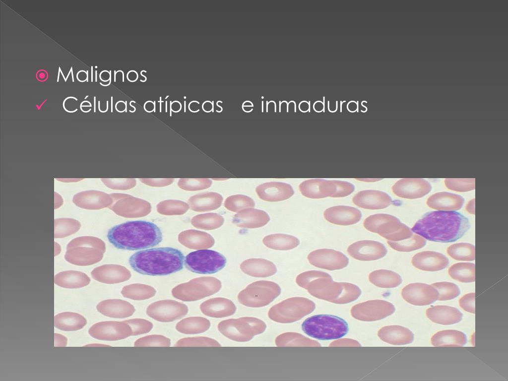 PPT - INTERPRETACION DEL HEMOGRAMA EN PEDIATRIA PowerPoint Presentation ...