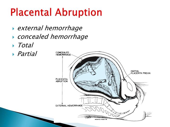 PPT - Antepartum Hemorrhage (APH) PowerPoint Presentation - ID:2121644