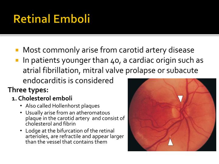 PPT - Case 3 PowerPoint Presentation - ID:2121758