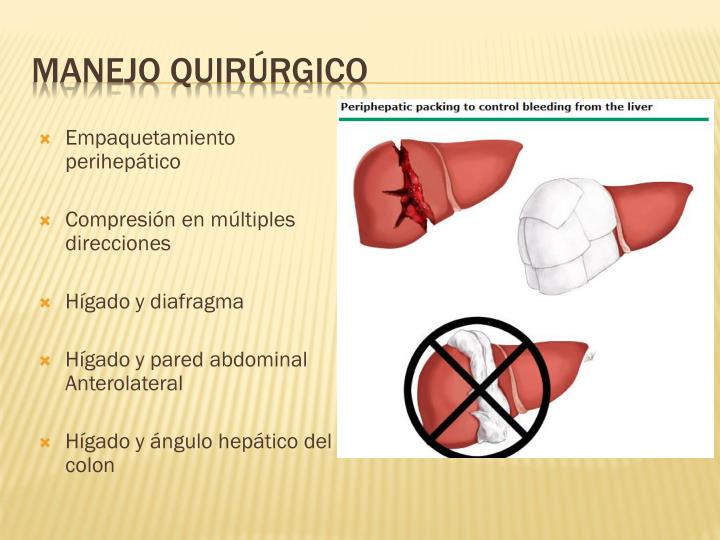 PPT - TRAUMA HEPÁTICO Y ESPLÉNICO PowerPoint Presentation - ID:2121796