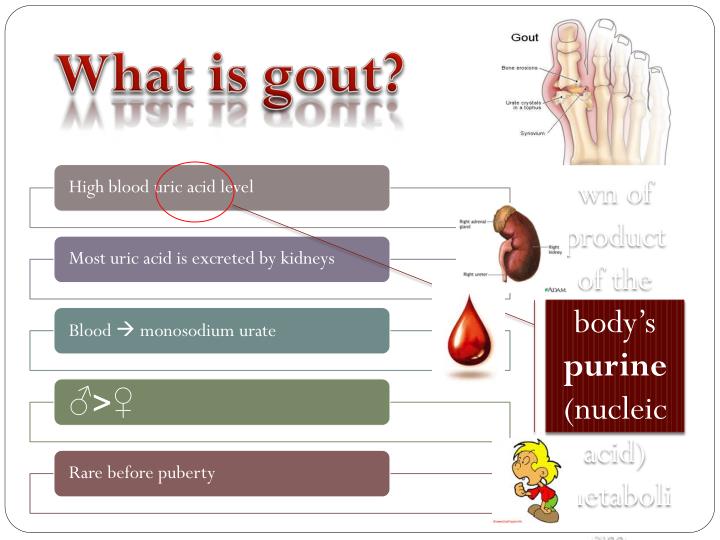 PPT - GOUT PowerPoint Presentation - ID:2122002