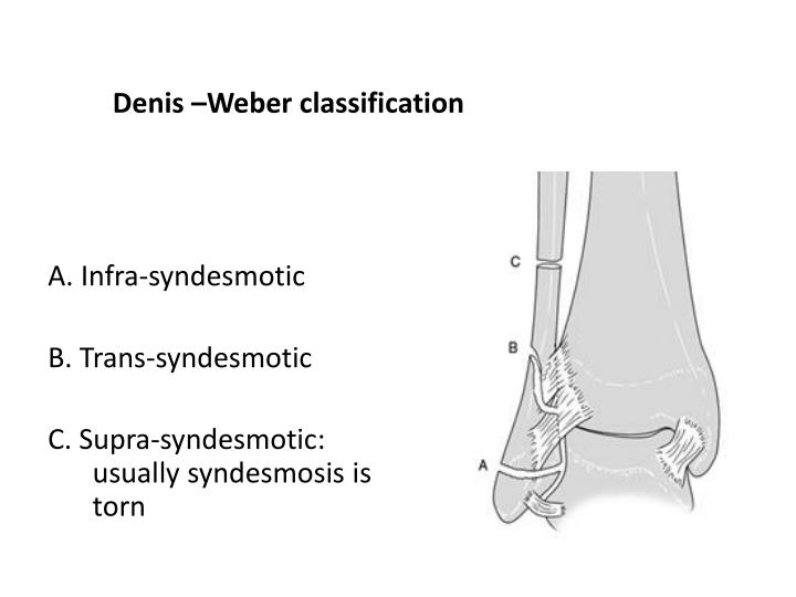 PPT - Common Adult Fractures PowerPoint Presentation - ID:2122118