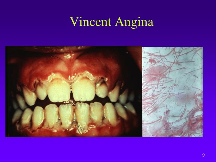 PPT - Anaerobic Bacteria PowerPoint Presentation - ID:2122265