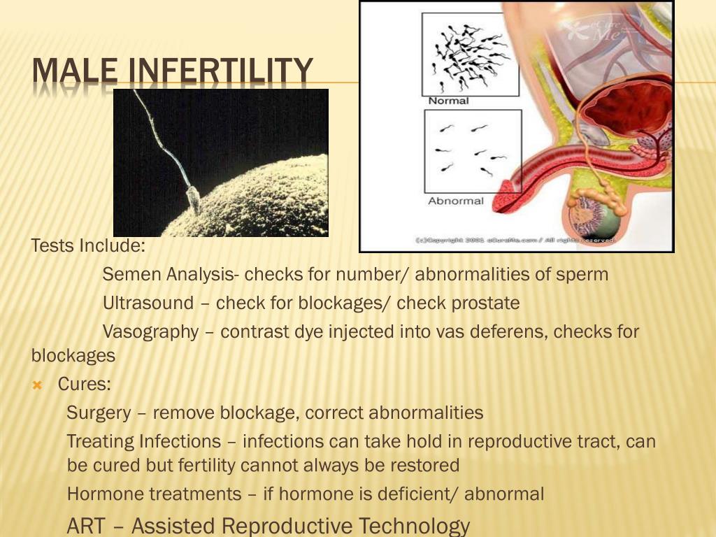 Ppt The Reproductive System Powerpoint Presentation Free Download