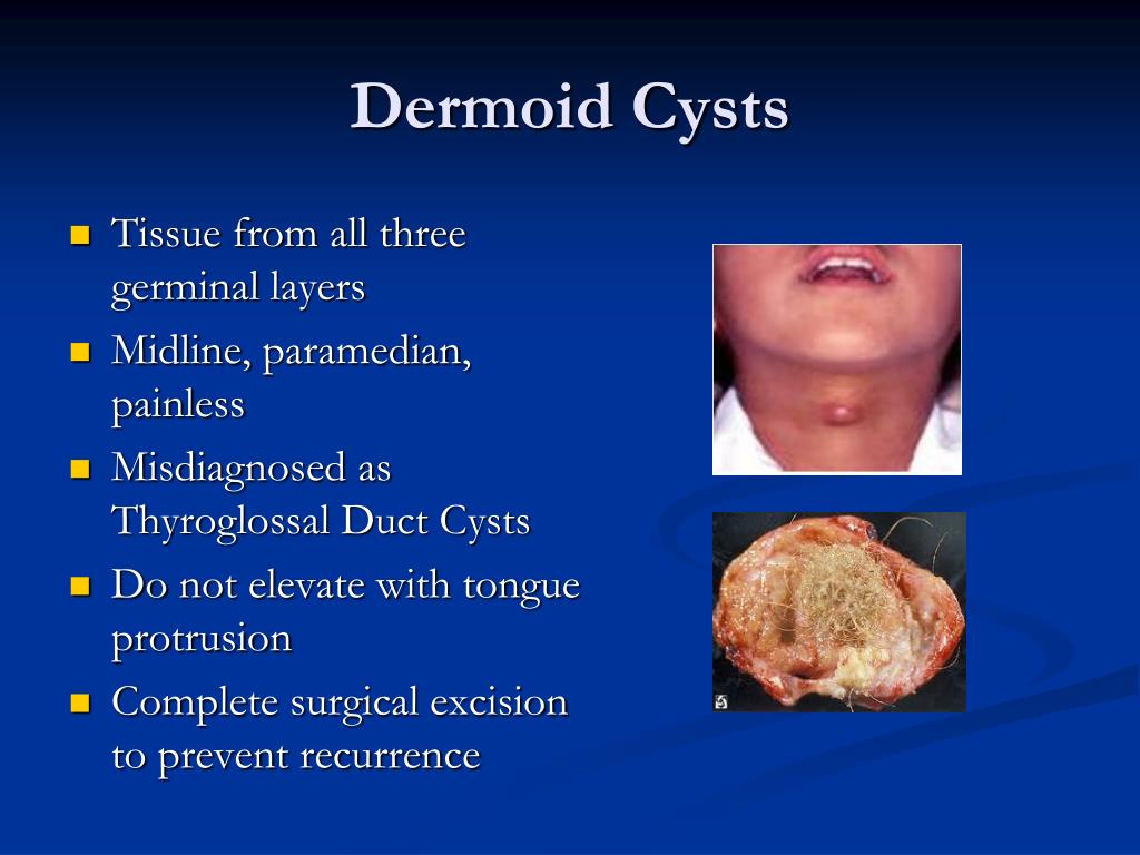 PPT - Head & Neck Masses including Salivary Glands PowerPoint ...