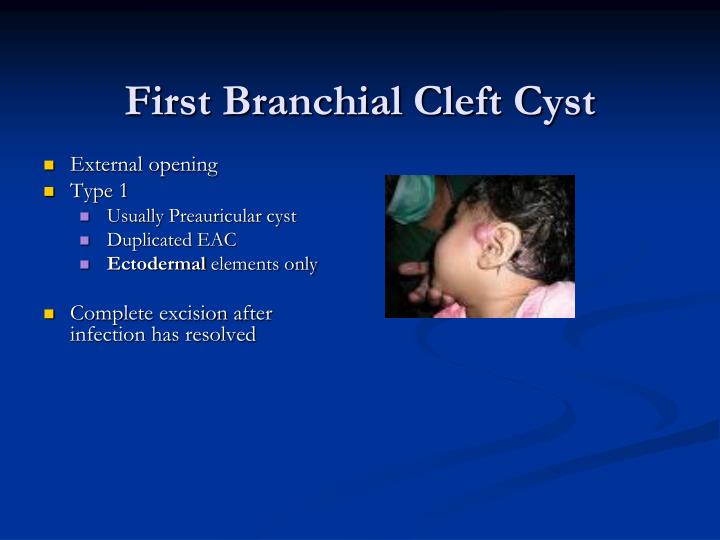 PPT - Head & Neck Masses including Salivary Glands PowerPoint ...