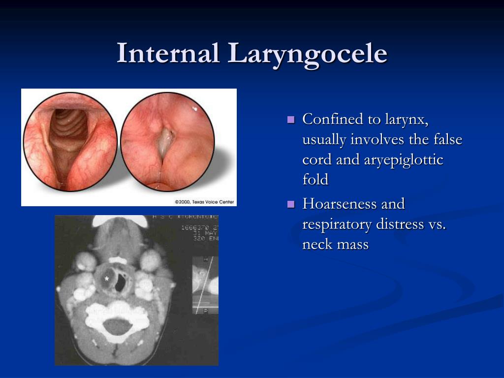 PPT - Head & Neck Masses including Salivary Glands PowerPoint ...